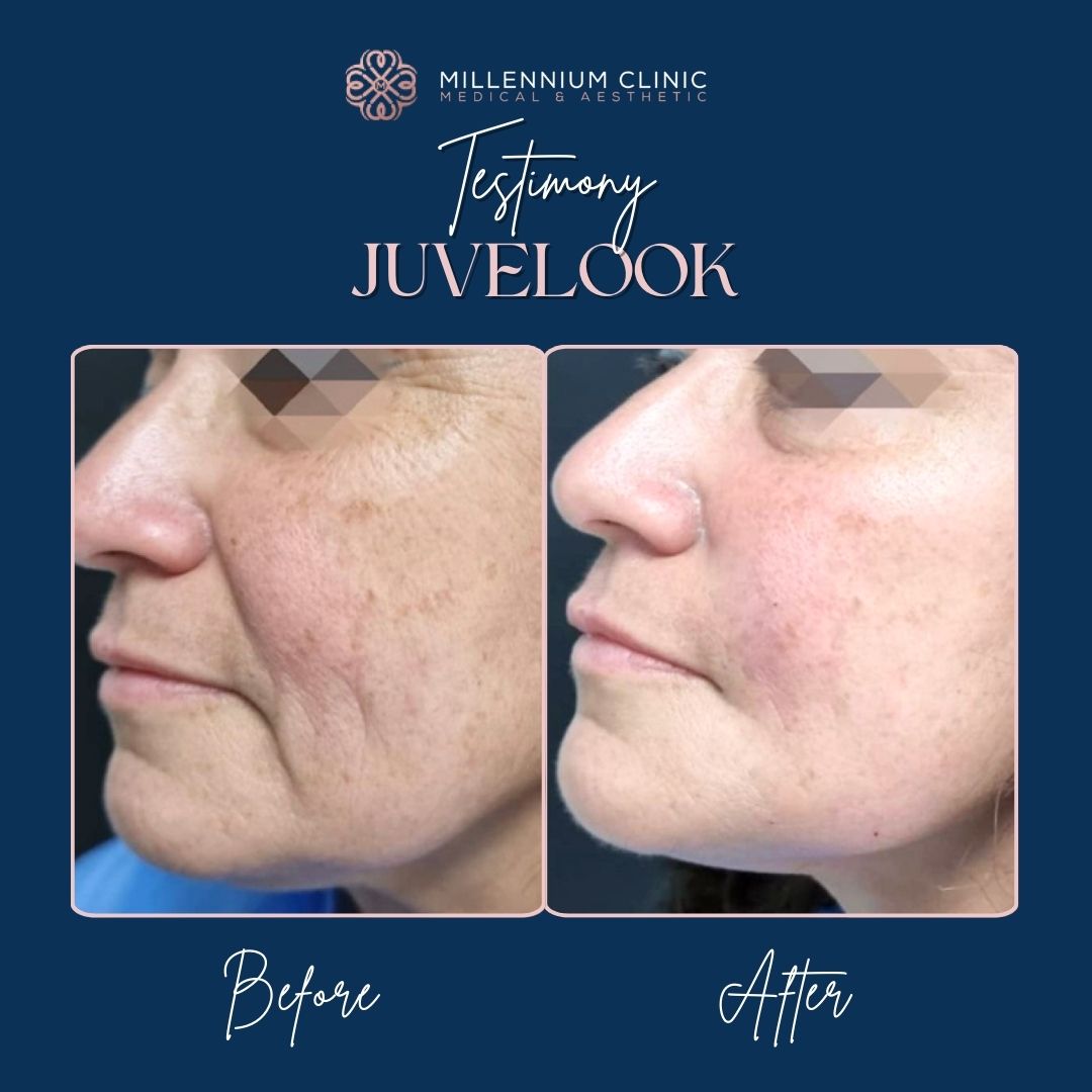 JuveLook - Millennium Clinic KL